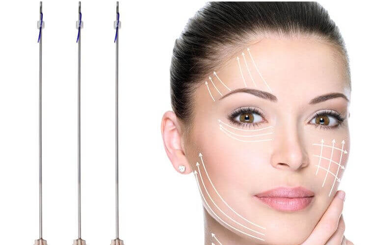 PDO Threads in Sutton Coldfield, Birmingham | The Aesthetic Labs